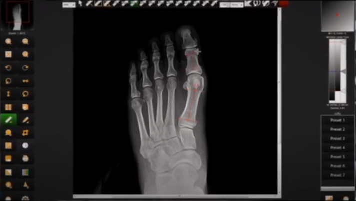 Podiatry Imaging - Pacific Med Image